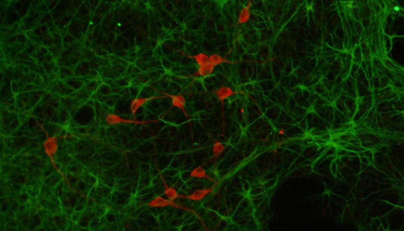 More Than Just a Pretty Protein | Concordia College